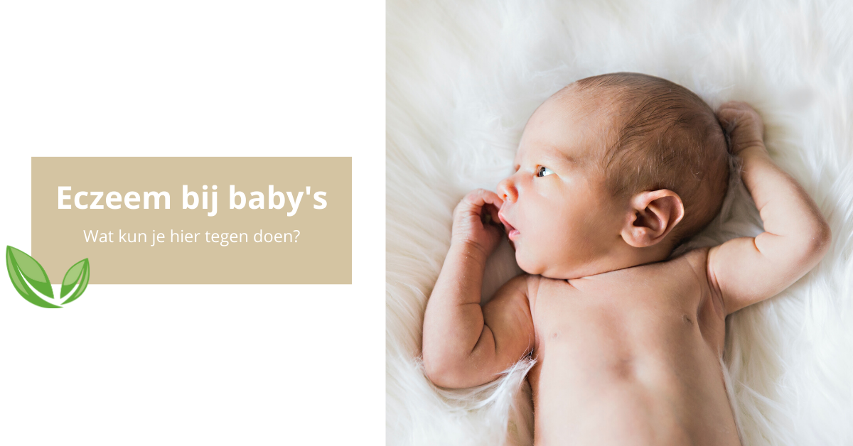 Eczeem bij baby’s
